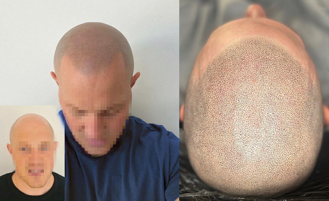 Bold Shaved Look – Andreea Paval SMP